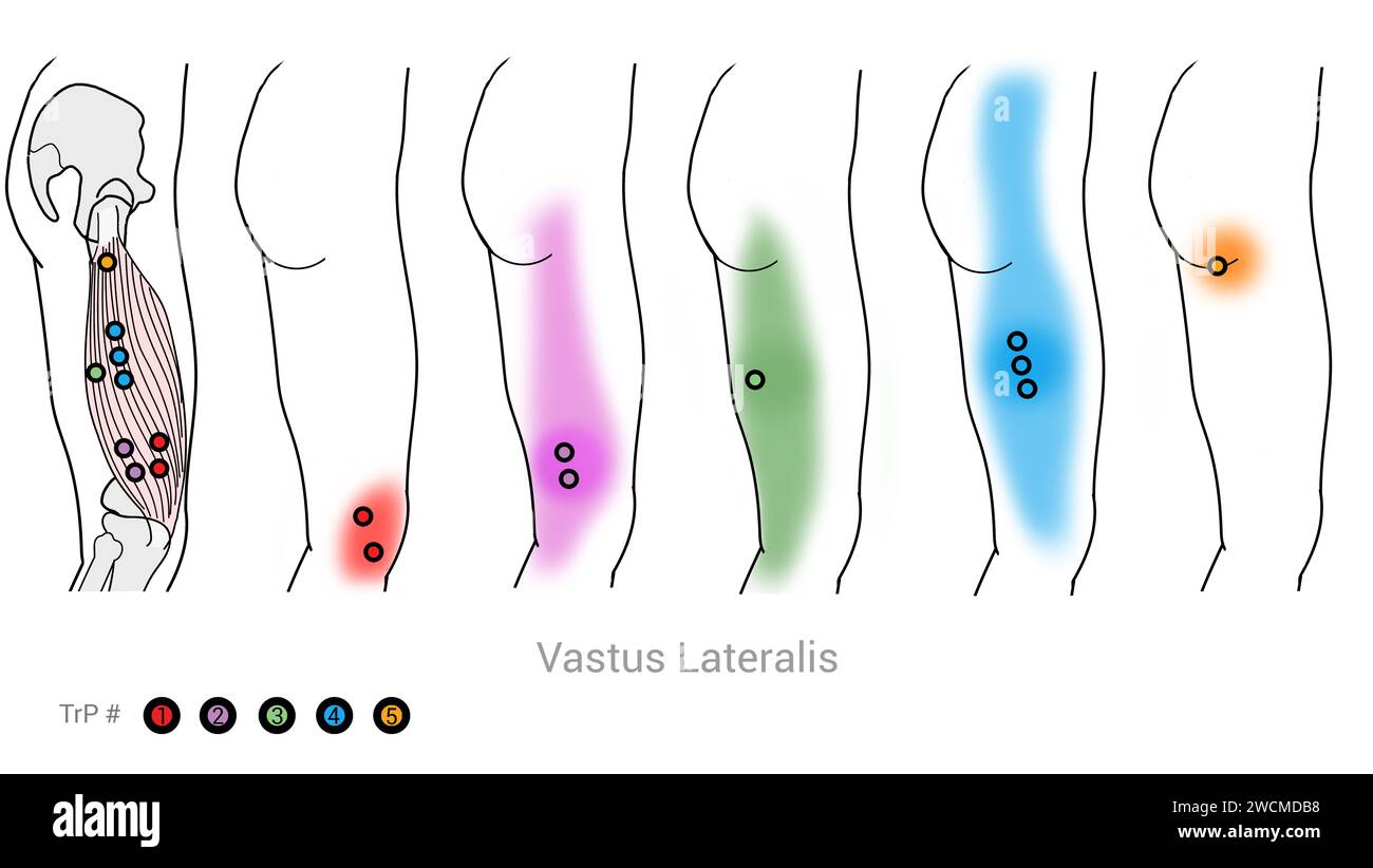 Medical illustration of vastus lateralis muscle Cut Out Stock Images ...