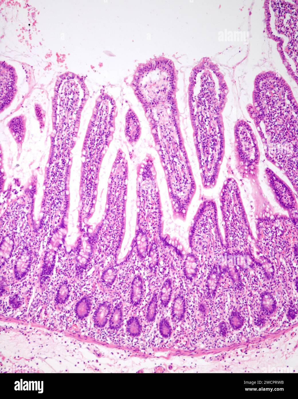 Mucosa of the ileum, light micrograph Stock Photo - Alamy