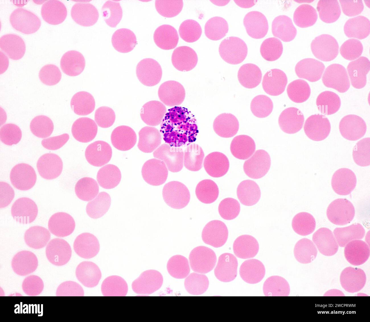 Basophil in blood smear, light micrograph Stock Photo - Alamy