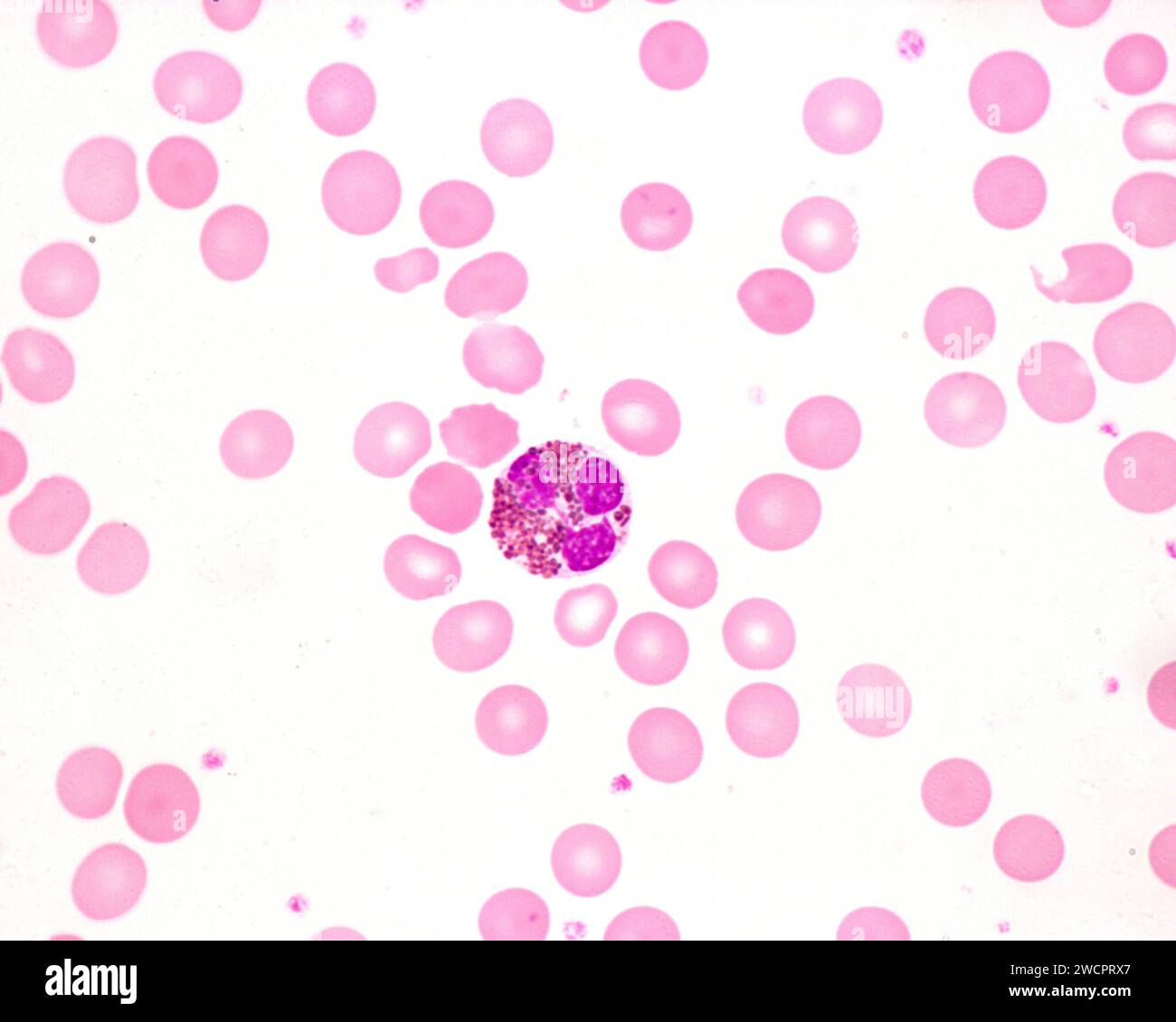 Eosinophil in blood smear, light micrograph Stock Photo - Alamy