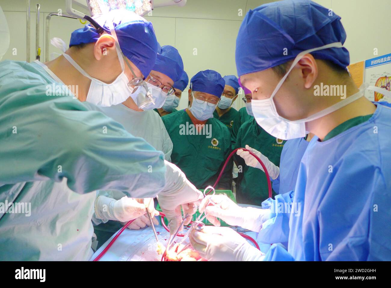 (240118) -- GUANGZHOU, Jan. 18, 2024 (Xinhua) -- The ischemia-free organ transplantation (IFOT ...