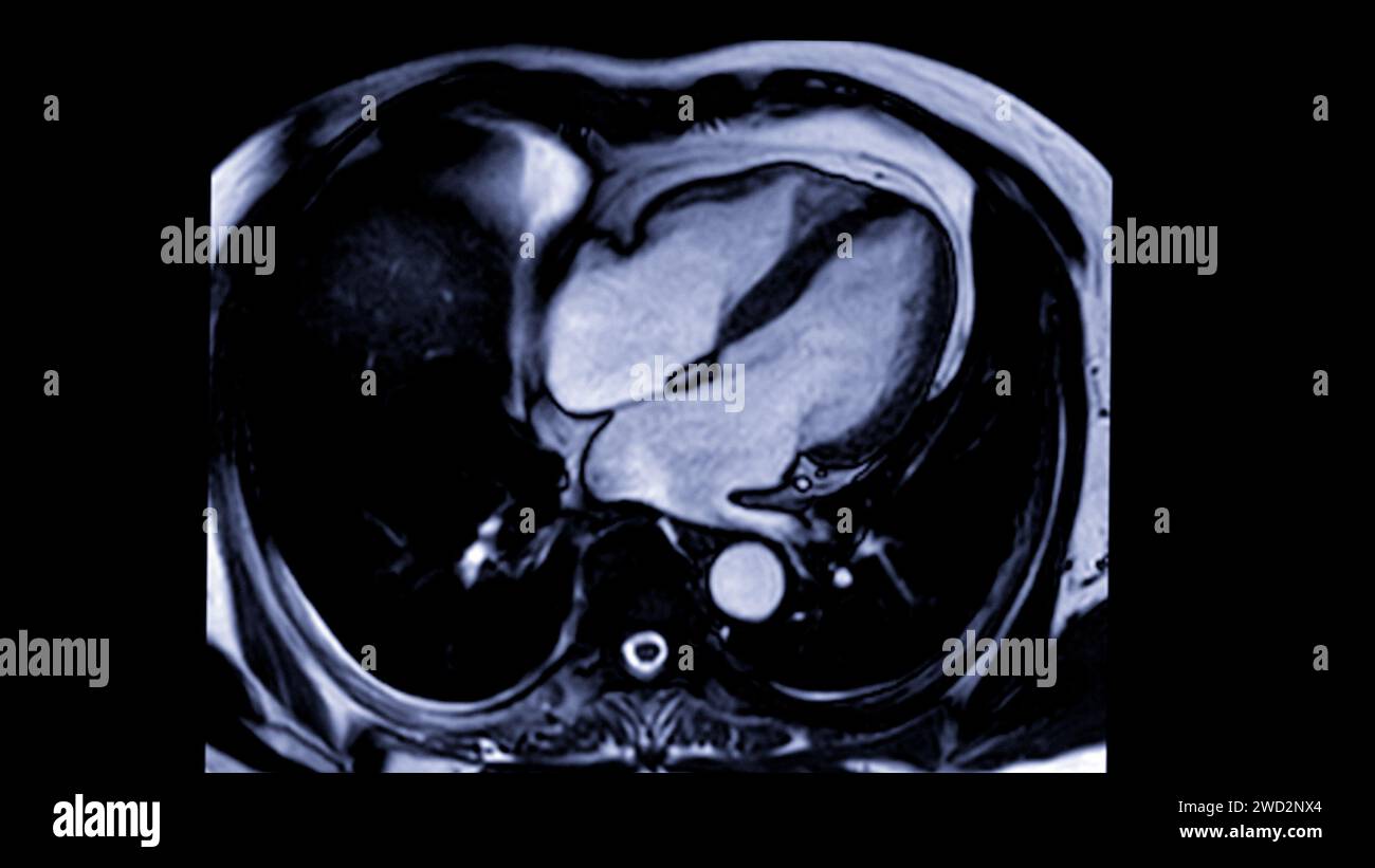 Cardiac MRI images are instrumental in assessing cardiac health ...