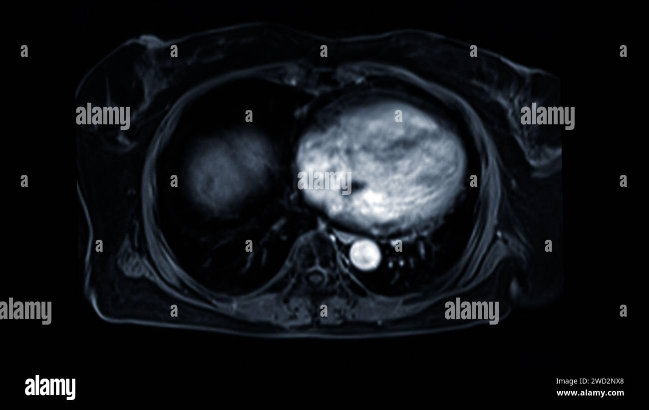 Cardiac MRI images are instrumental in assessing cardiac health ...