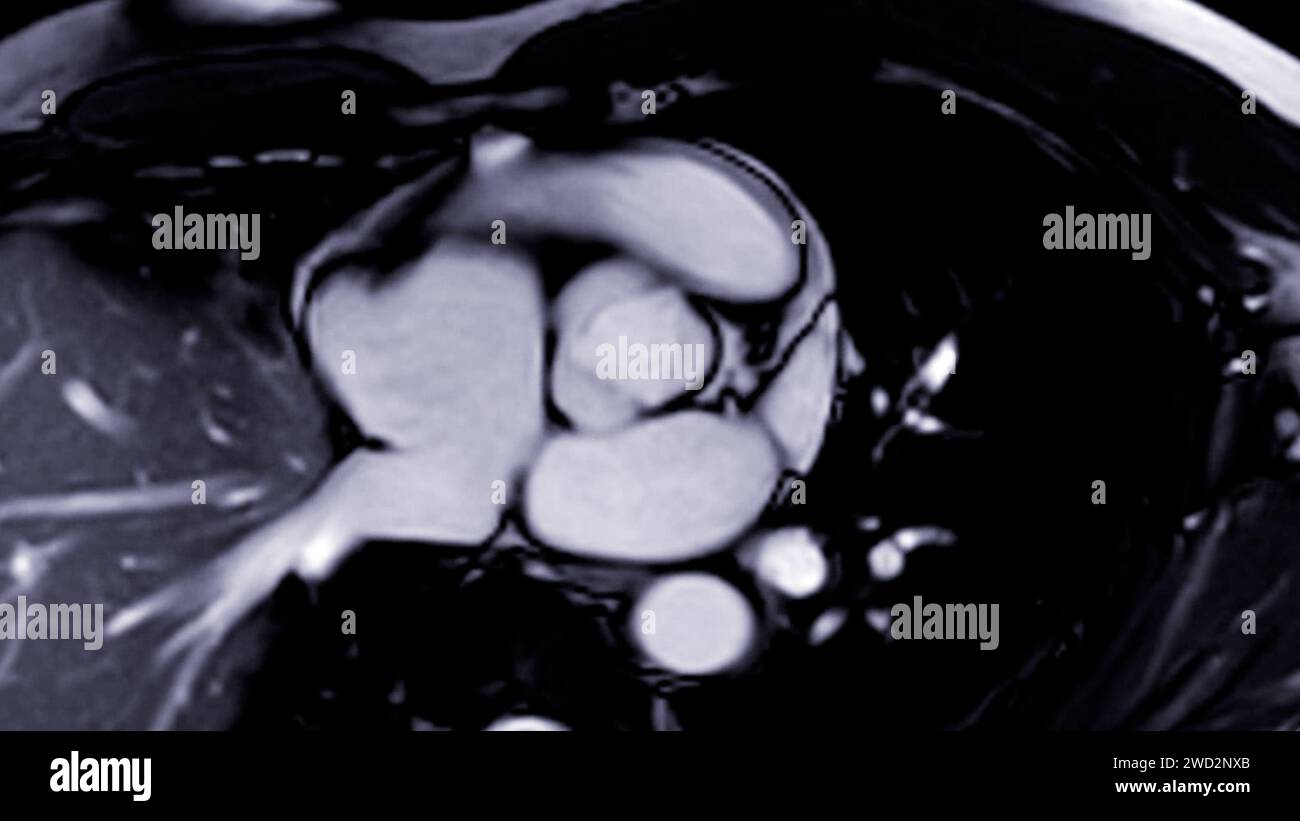 Cardiac MRI images are instrumental in assessing cardiac health ...