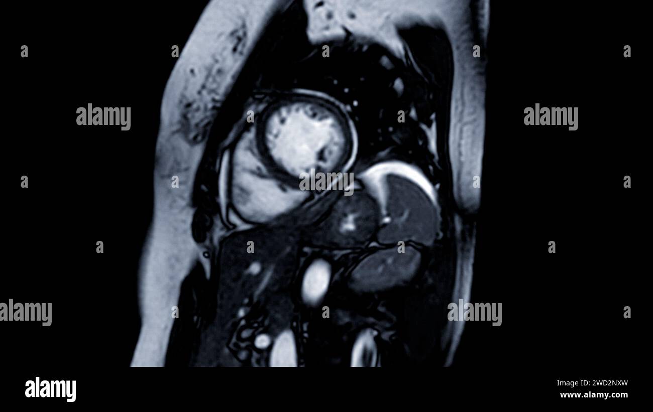Cardiac MRI images are instrumental in assessing cardiac health ...