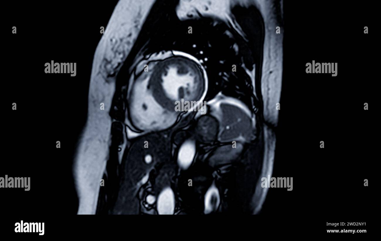 Cardiac MRI images are instrumental in assessing cardiac health ...