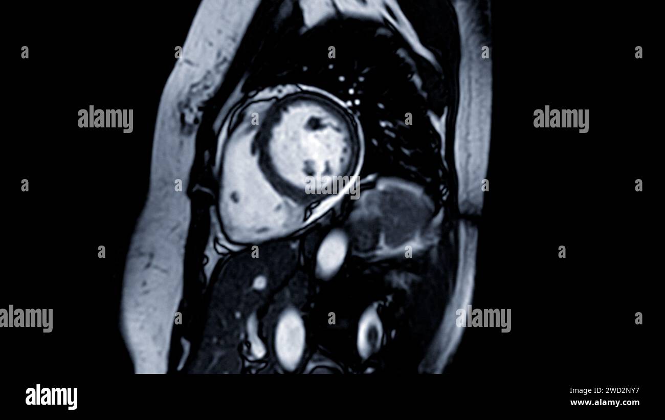 Cardiac MRI images are instrumental in assessing cardiac health ...