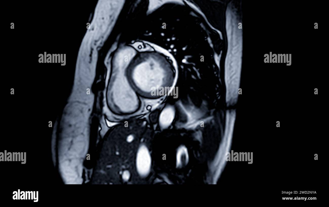Cardiac MRI images are instrumental in assessing cardiac health ...