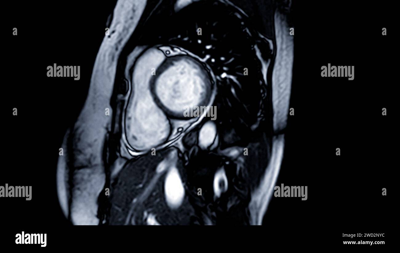 Cardiac MRI images are instrumental in assessing cardiac health ...