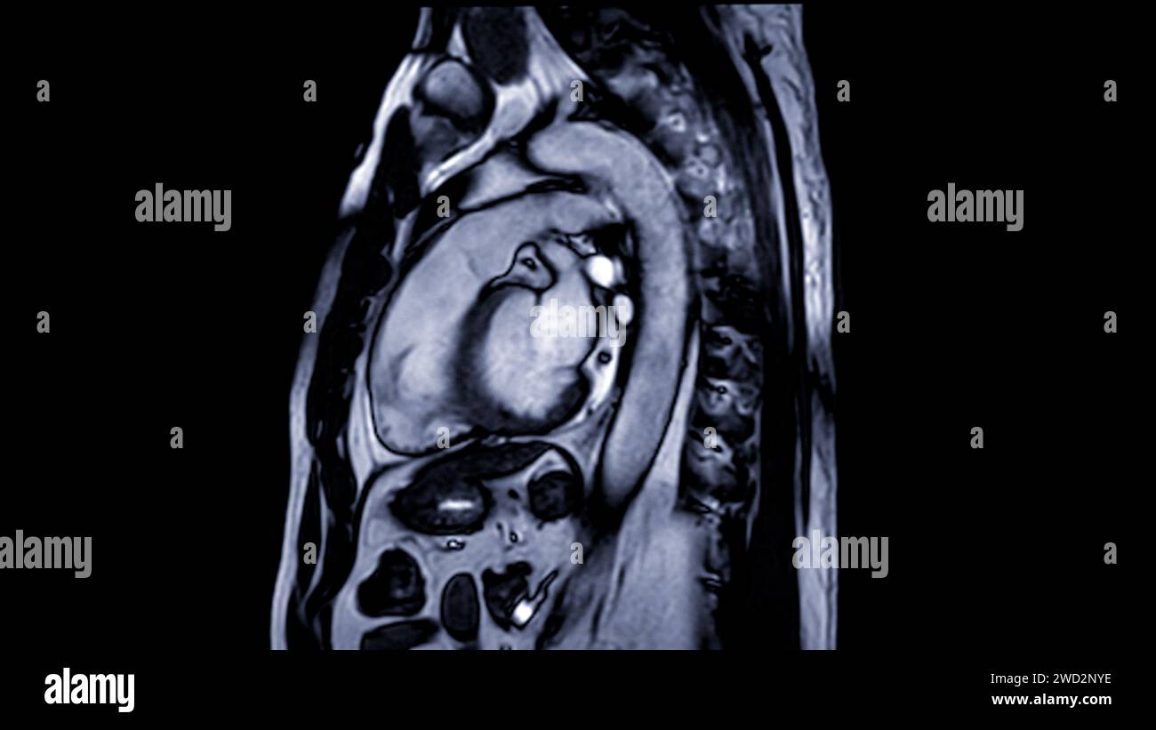 Cardiac MRI images are instrumental in assessing cardiac health ...