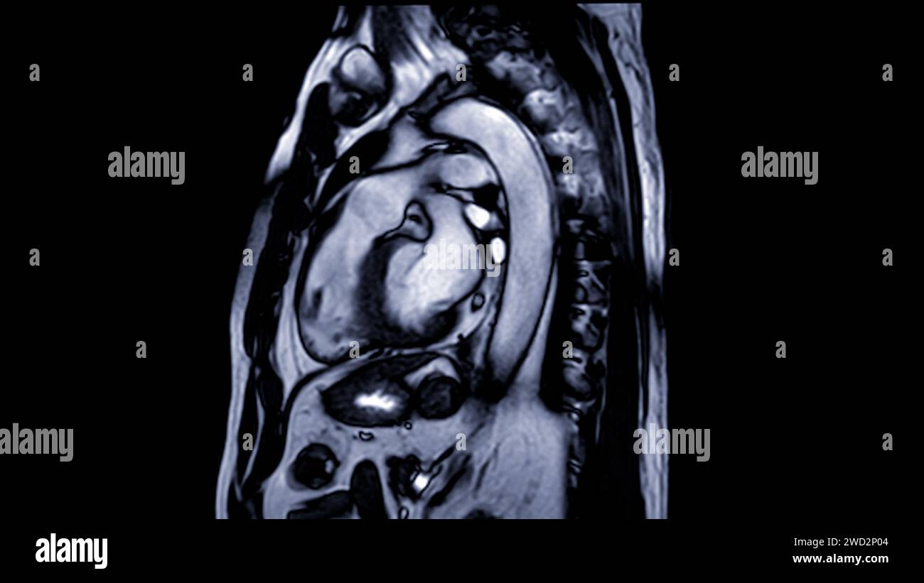Cardiac MRI images are instrumental in assessing cardiac health ...