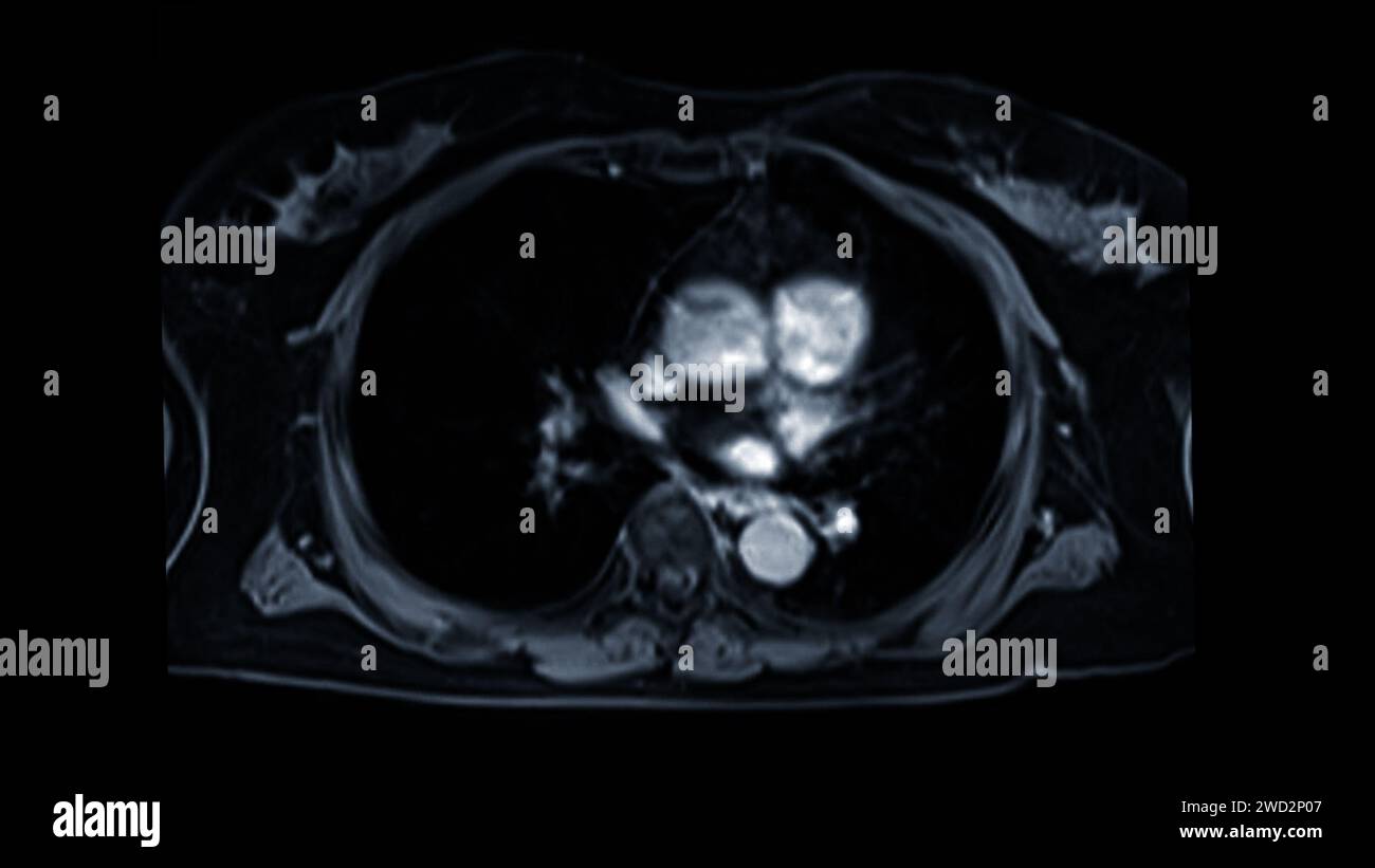 Cardiac MRI images are instrumental in assessing cardiac health ...