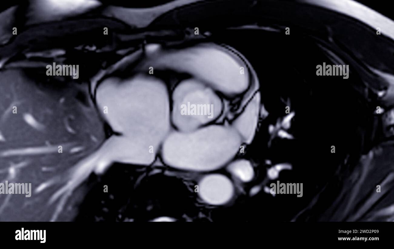 Cardiac MRI images are instrumental in assessing cardiac health ...