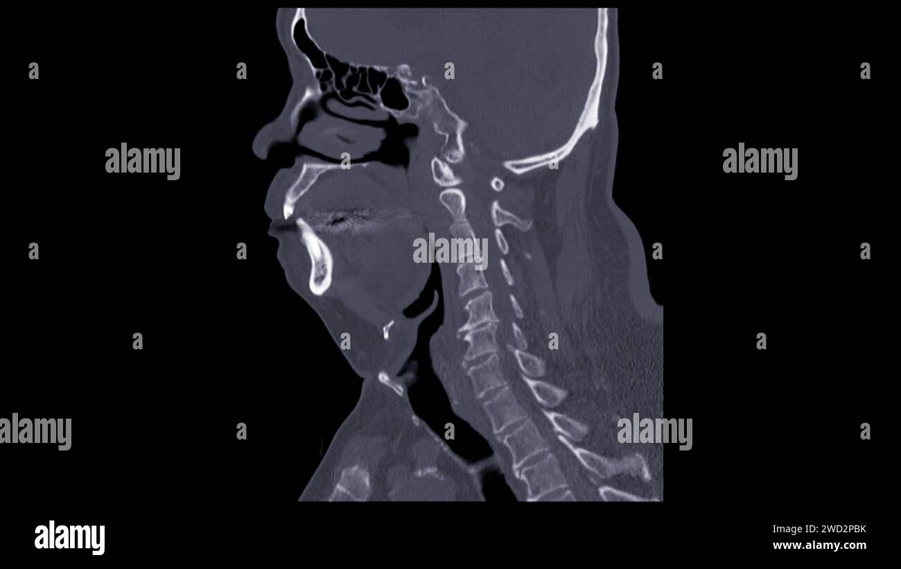 A CT scan of the neck sagittal view for diagnostic technique is ...