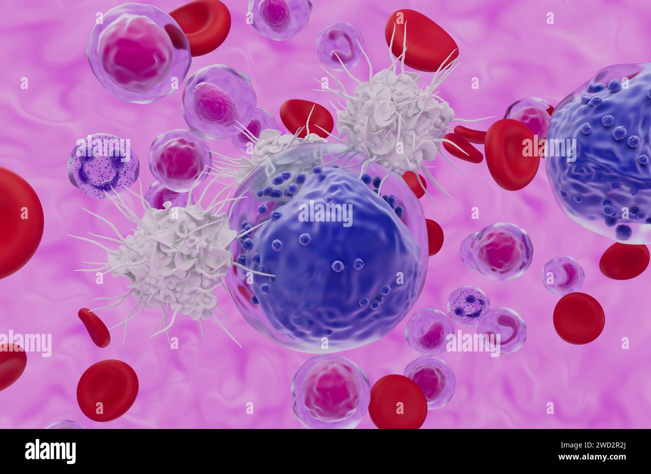 Dendritic cell recognize Acute myeloid leukaemia (AML) cell - closeup ...