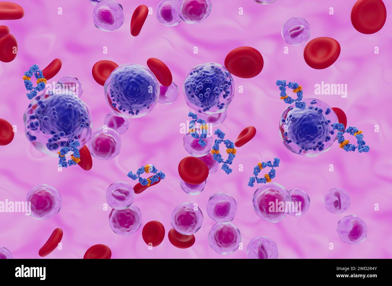 Monoclonal antibody treatment in Acute myeloid leukaemia (AML ...
