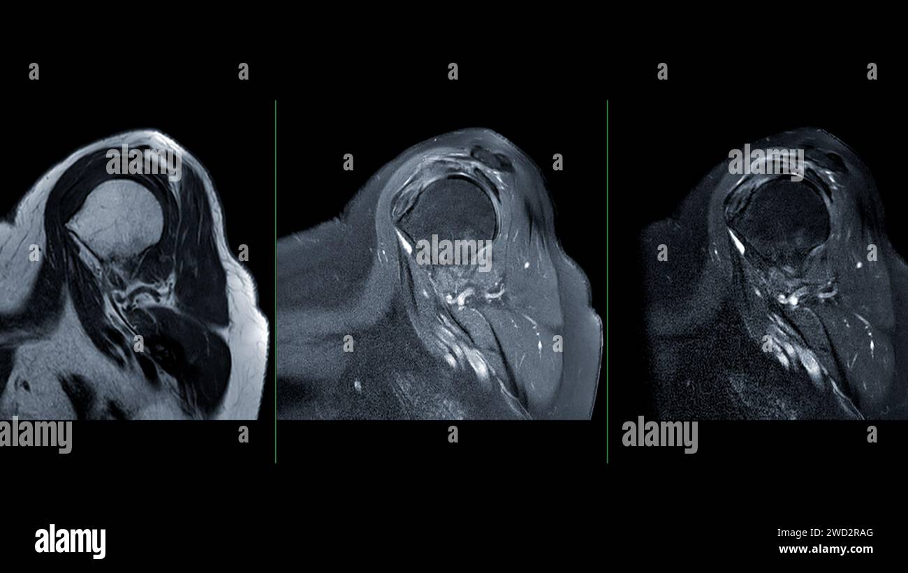 Musculoskeletal hi-res stock photography and images - Alamy