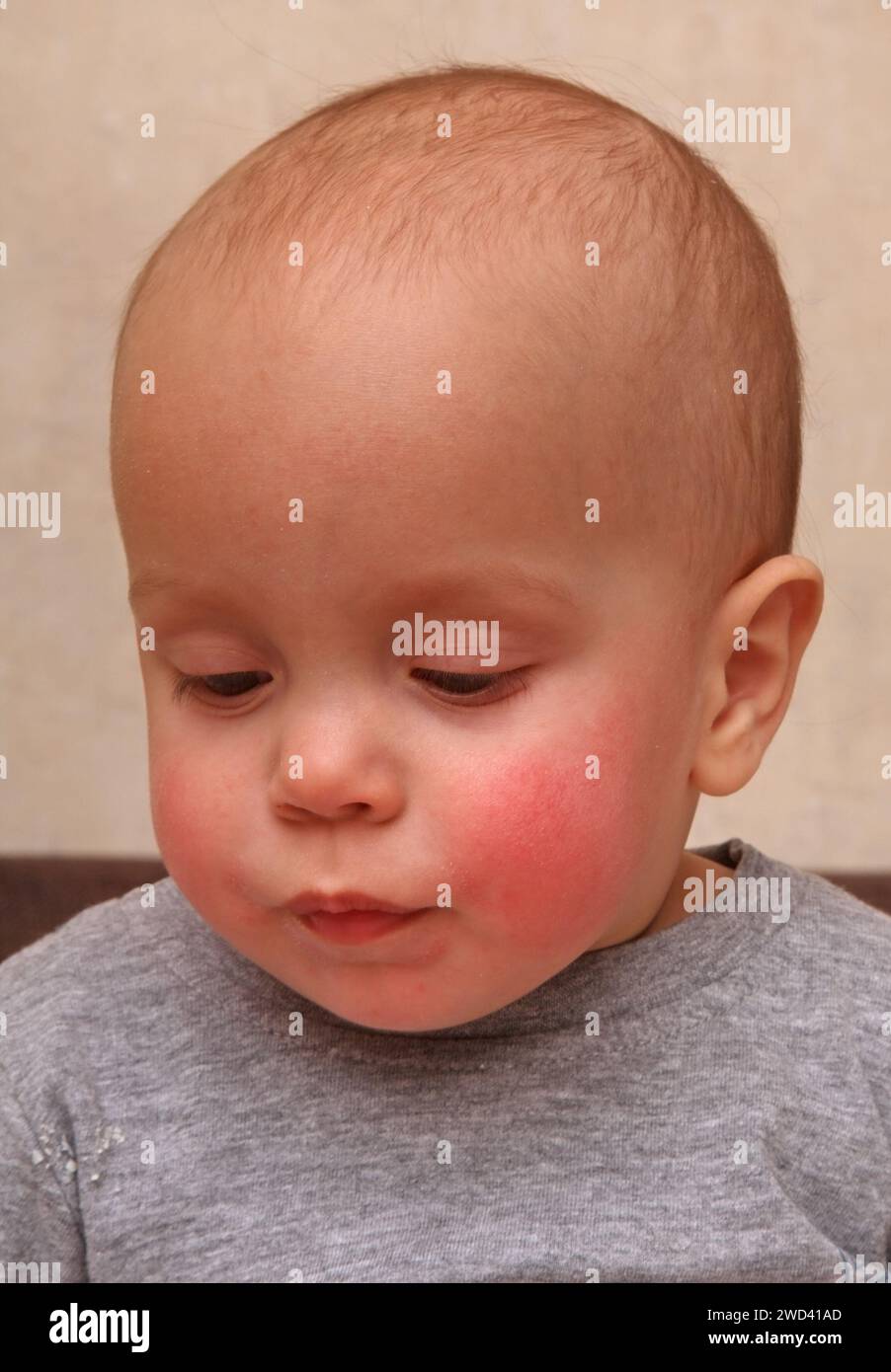 Small boy with pink cheeks Stock Photo - Alamy