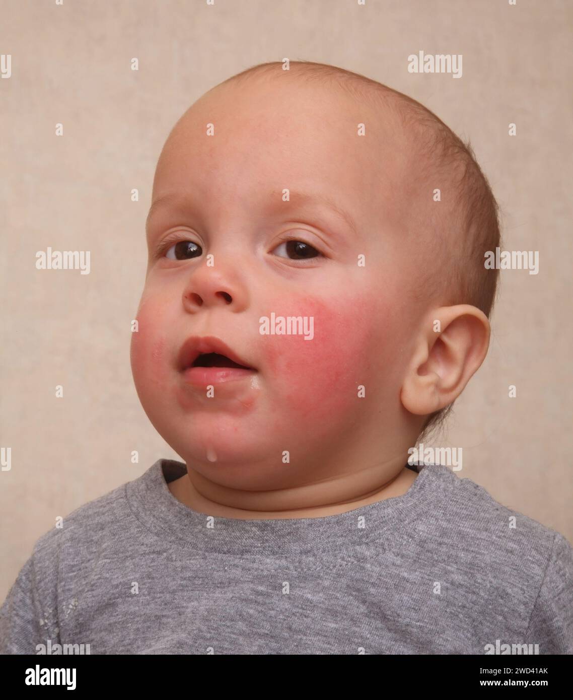 Small boy with pink cheeks Stock Photo - Alamy