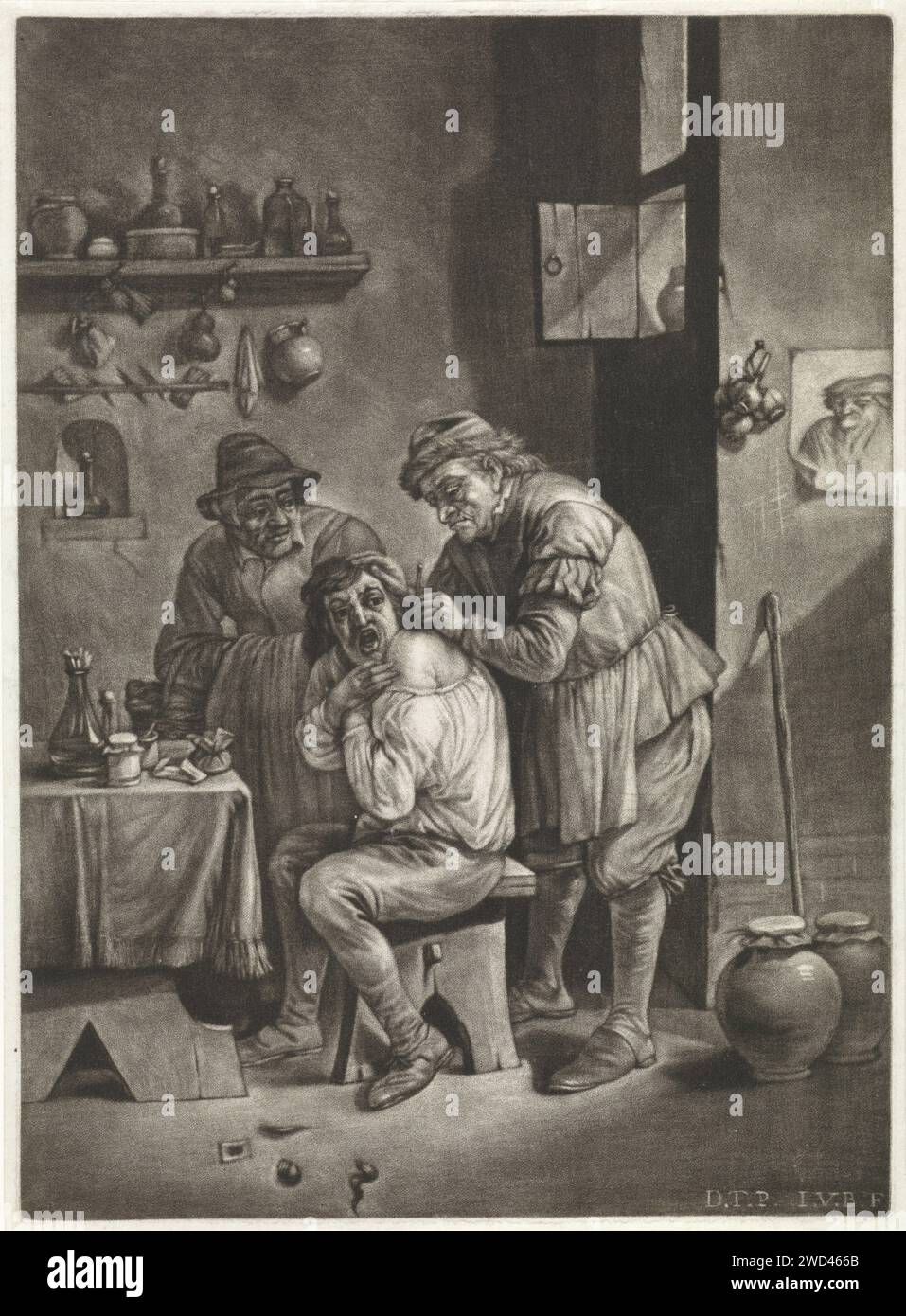 1740 surgery hi-res stock photography and images - Alamy