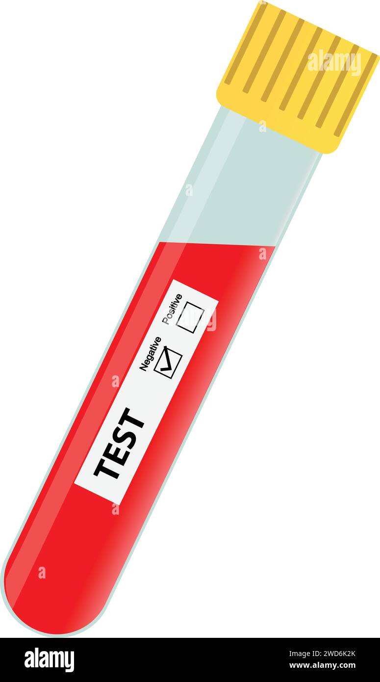 Blood Test Tube with blood, Medical Test blood sample, test result ...