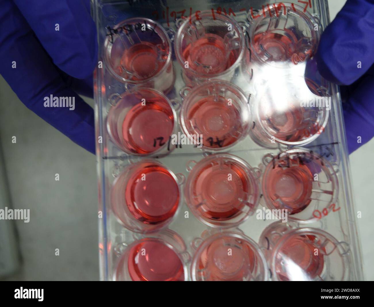 3-D Printed Eye Tissue (34100509955 Stock Photo - Alamy