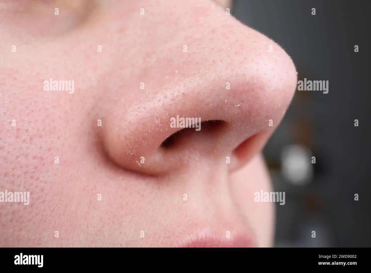 Itchy nose hi-res stock photography and images - Alamy