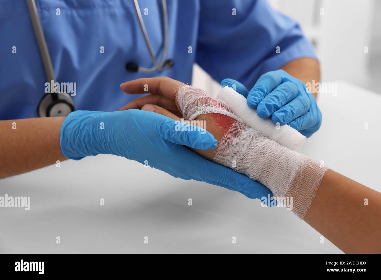 Doctor bandaging patient's burned hand at table, closeup Stock Photo ...