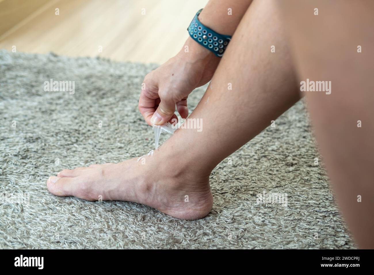 A woman's hand is peeling away dry skin. skin problems Stock Photo - Alamy