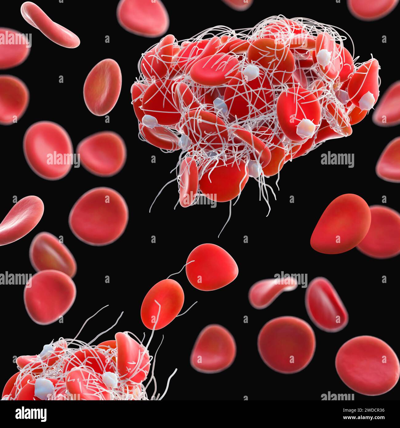 Blood clot clotted hi-res stock photography and images - Alamy