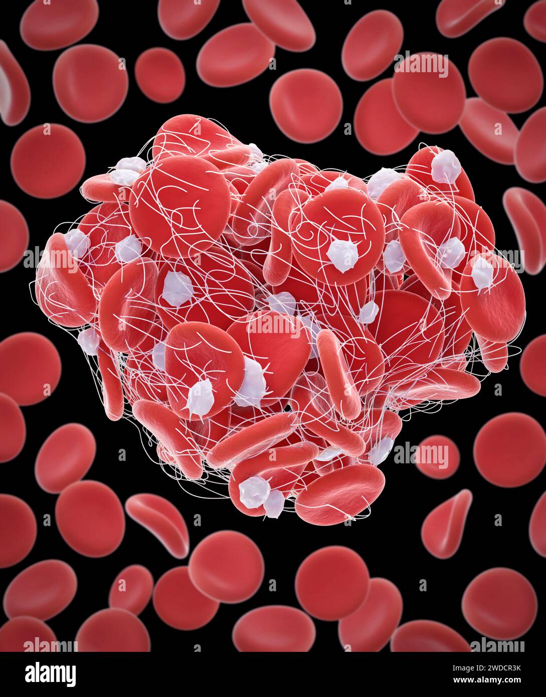 Blood clot clotted hi-res stock photography and images - Alamy