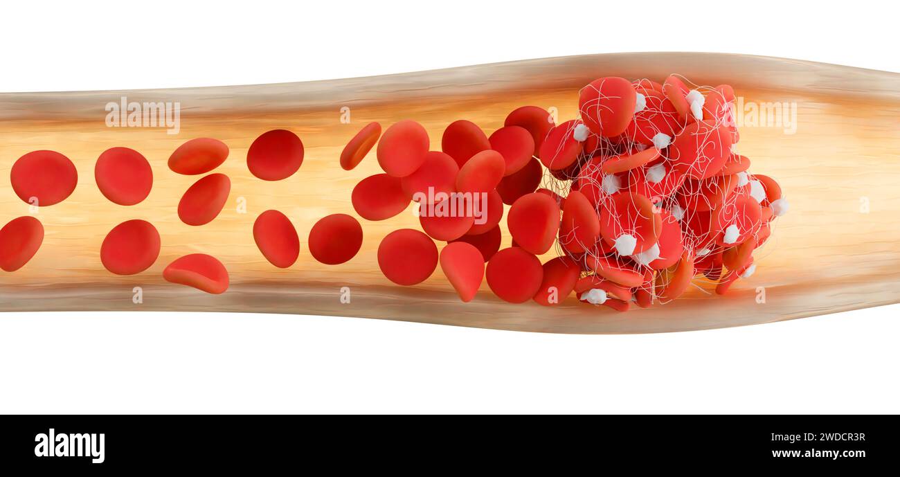 Illustration of a blood vessel with red blood cells (erythrocytes ...