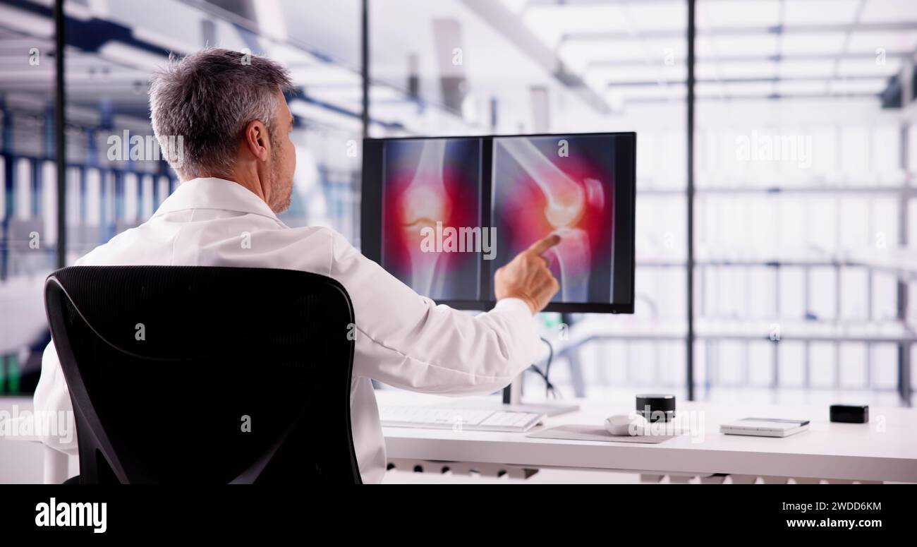 Surgeon holding xray knee hi-res stock photography and images - Alamy