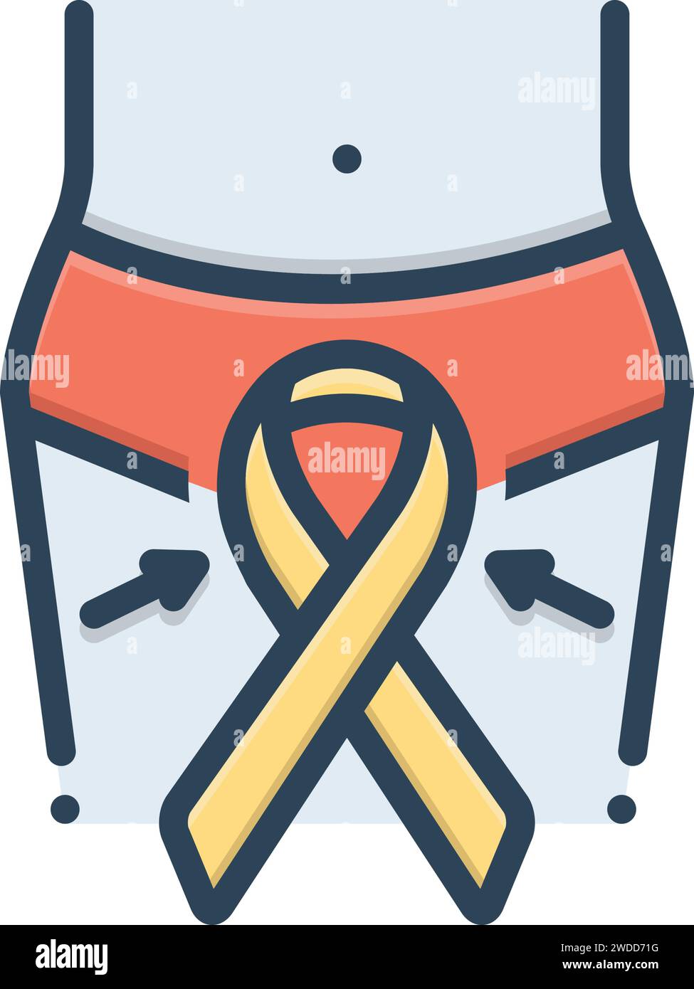 Brachytherapy hi-res stock photography and images - Alamy