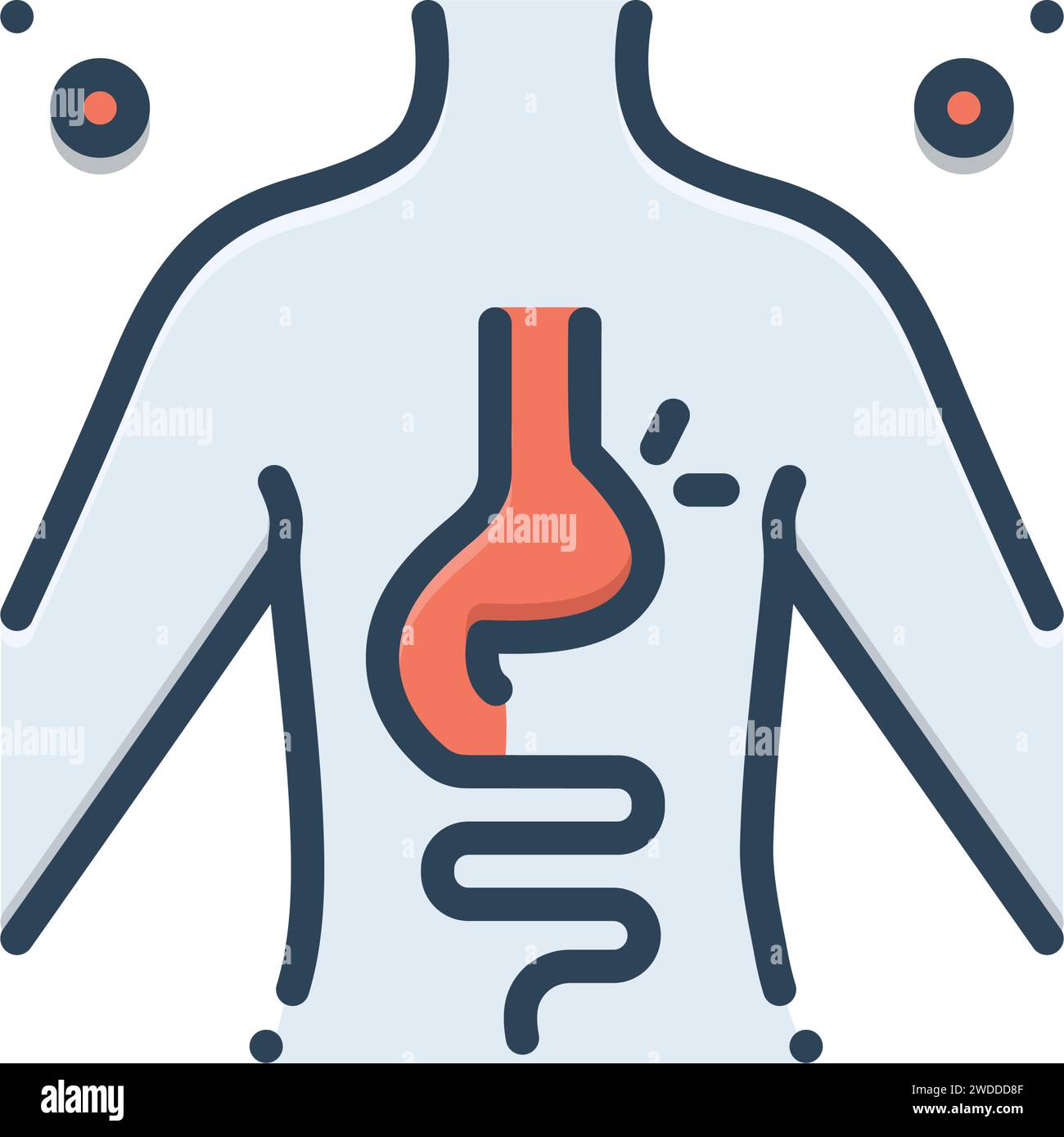 Inguinal hernia Stock Vector Images - Alamy