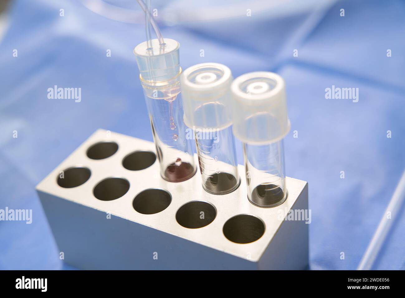 Close up of test tubes for eggcell retrieval or artificial insemination ...