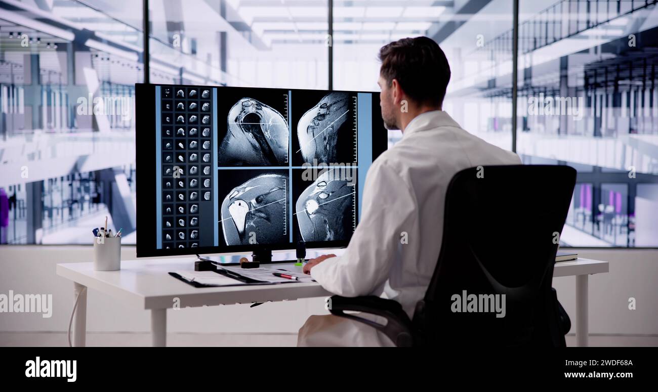 Doctor Screening Shoulder MRT Scan On Computer Stock Photo - Alamy