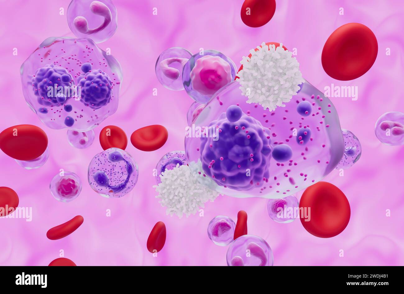 White blood cells with Multiple myeloma (MM) cells - closeup view 3d ...