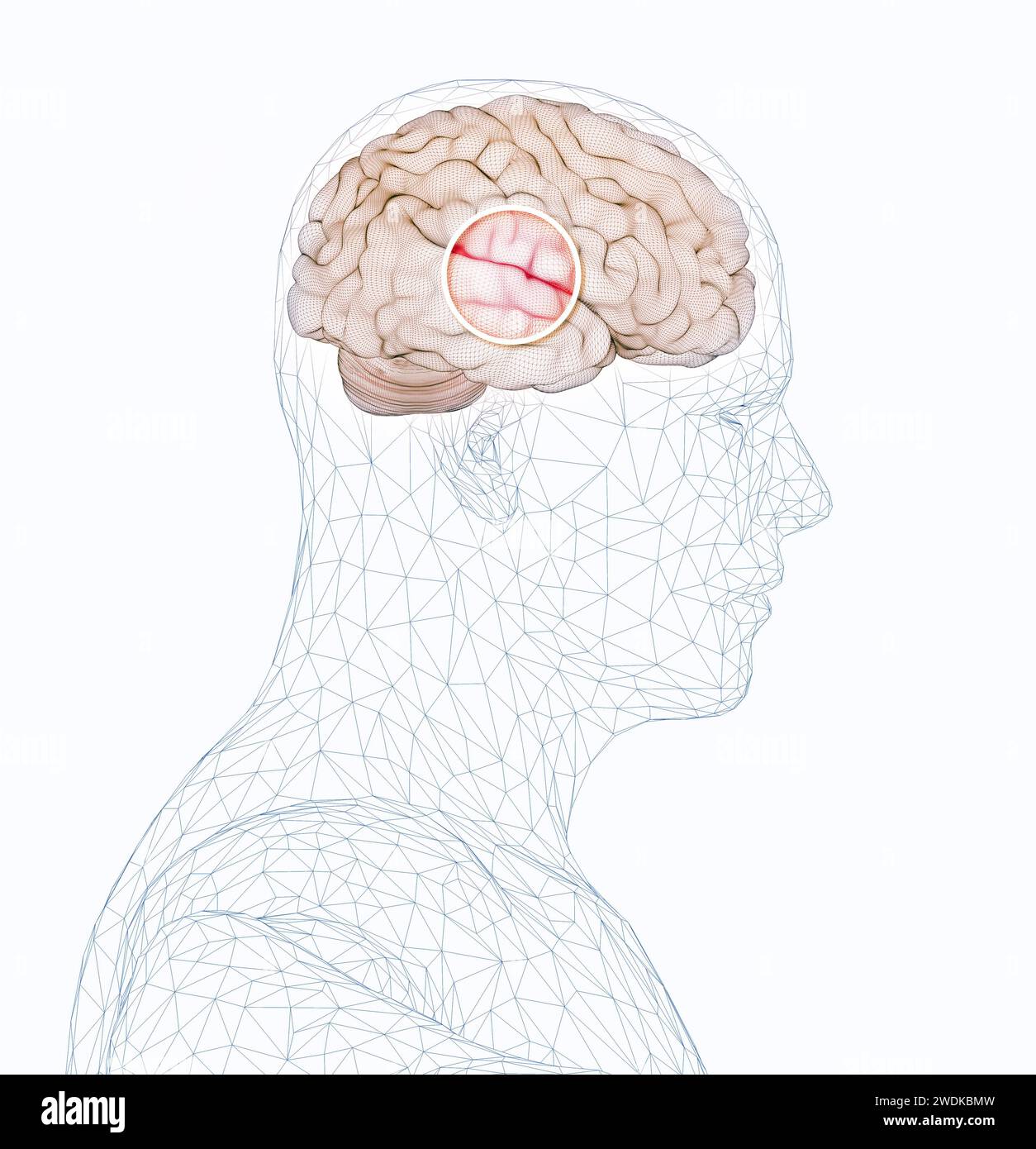 Memory lapses, forgetting things, degenerative disease. Brain problems ...