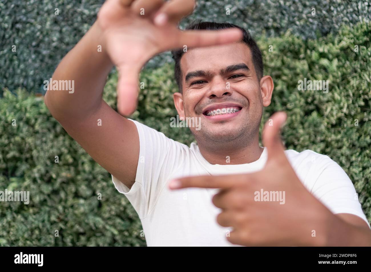 Man with dental braces framing face with fingers, greenery backdrop ...