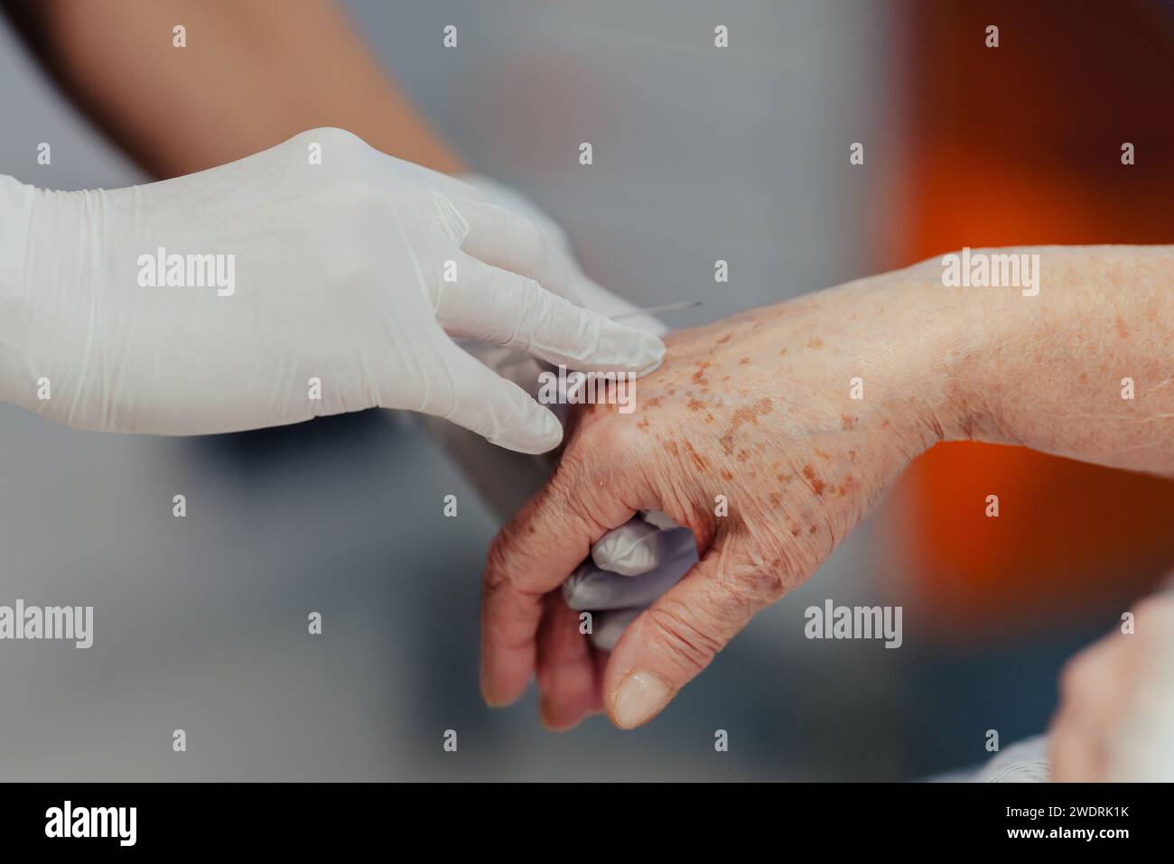Close up of nurse insering IV cannula in vein, hand. Senior woman in ...