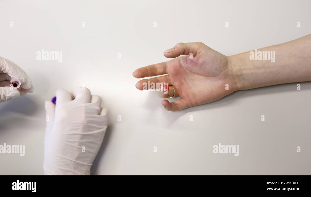 finger blood test, blood, test tube. High quality photo Stock Photo - Alamy