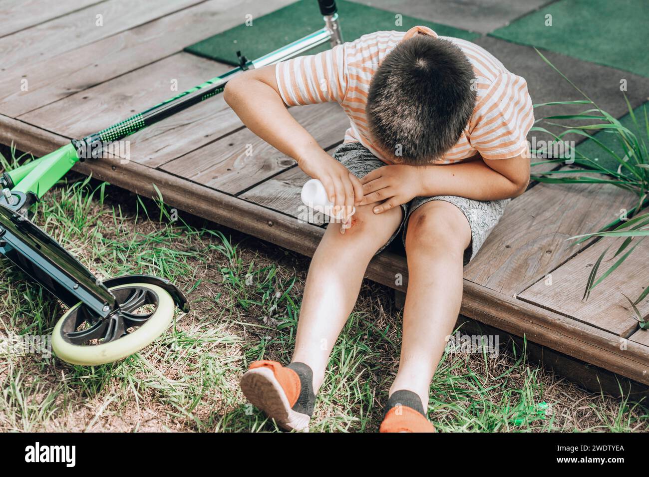 child's leg injury. The child injured his knee when he fell off the ...