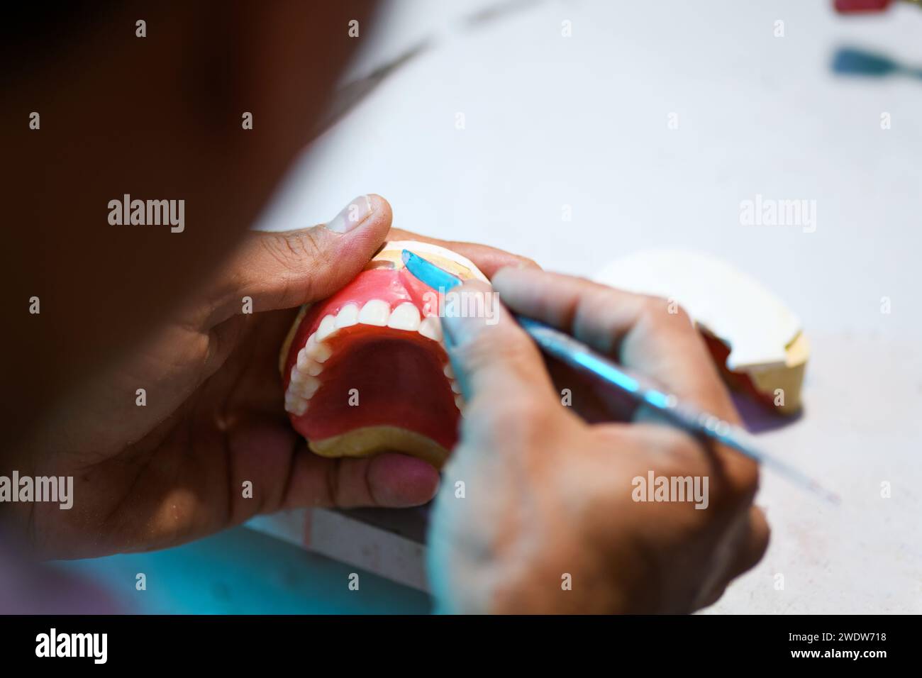 Close up of prosthetic dental craftsmanship, showcasing the detailed ...