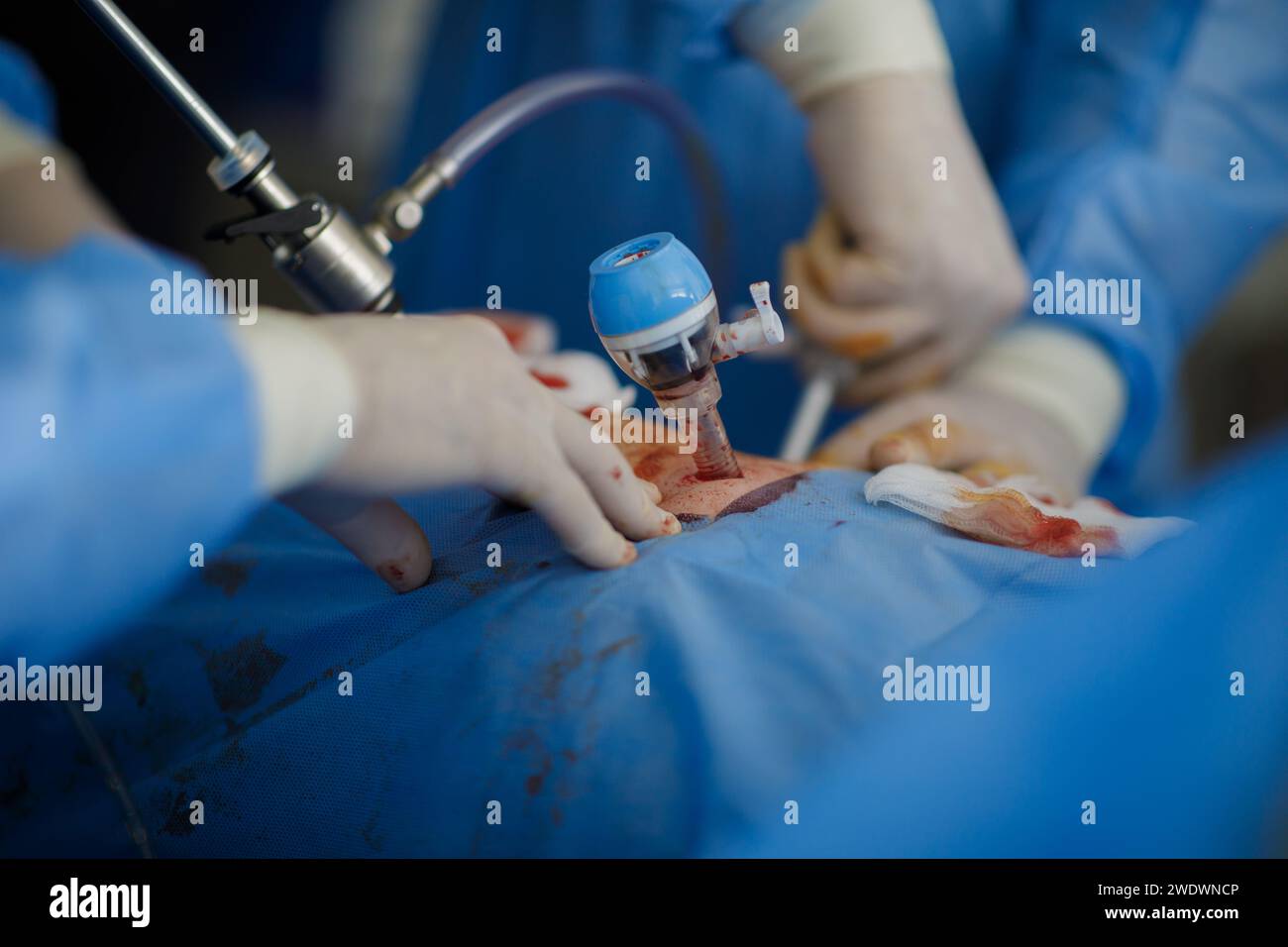 Endoscopy machines hi-res stock photography and images - Alamy