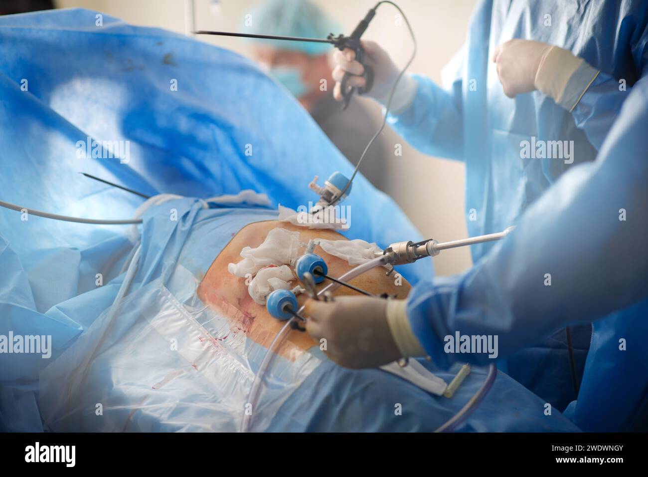 doctors perform laparoscopy operations in the intensive care unit. High ...