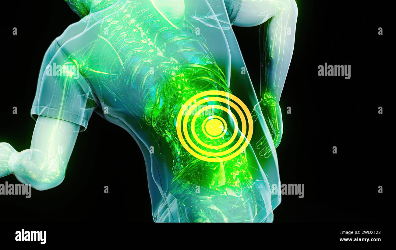 Backpain illustration hi-res stock photography and images - Alamy
