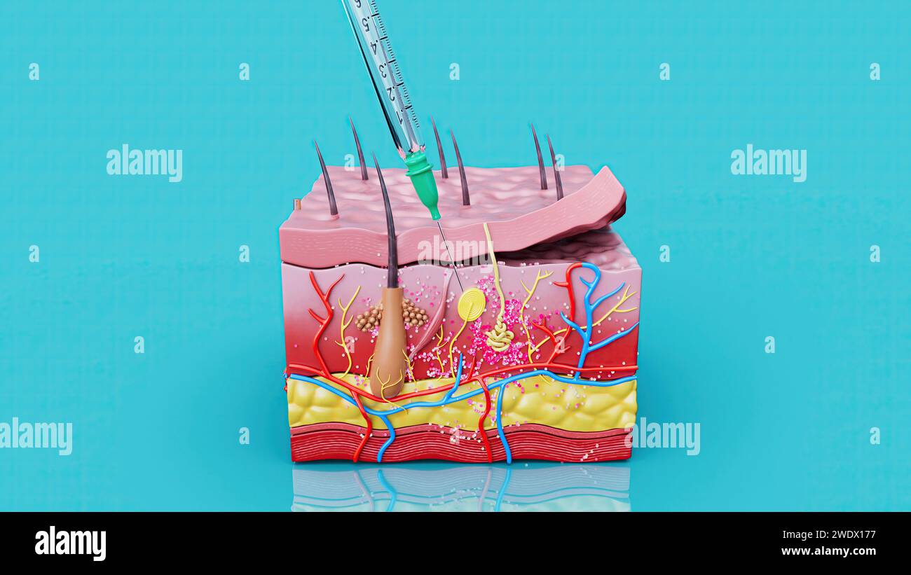Abstract illustration of a subcutaneous injection Stock Photo - Alamy