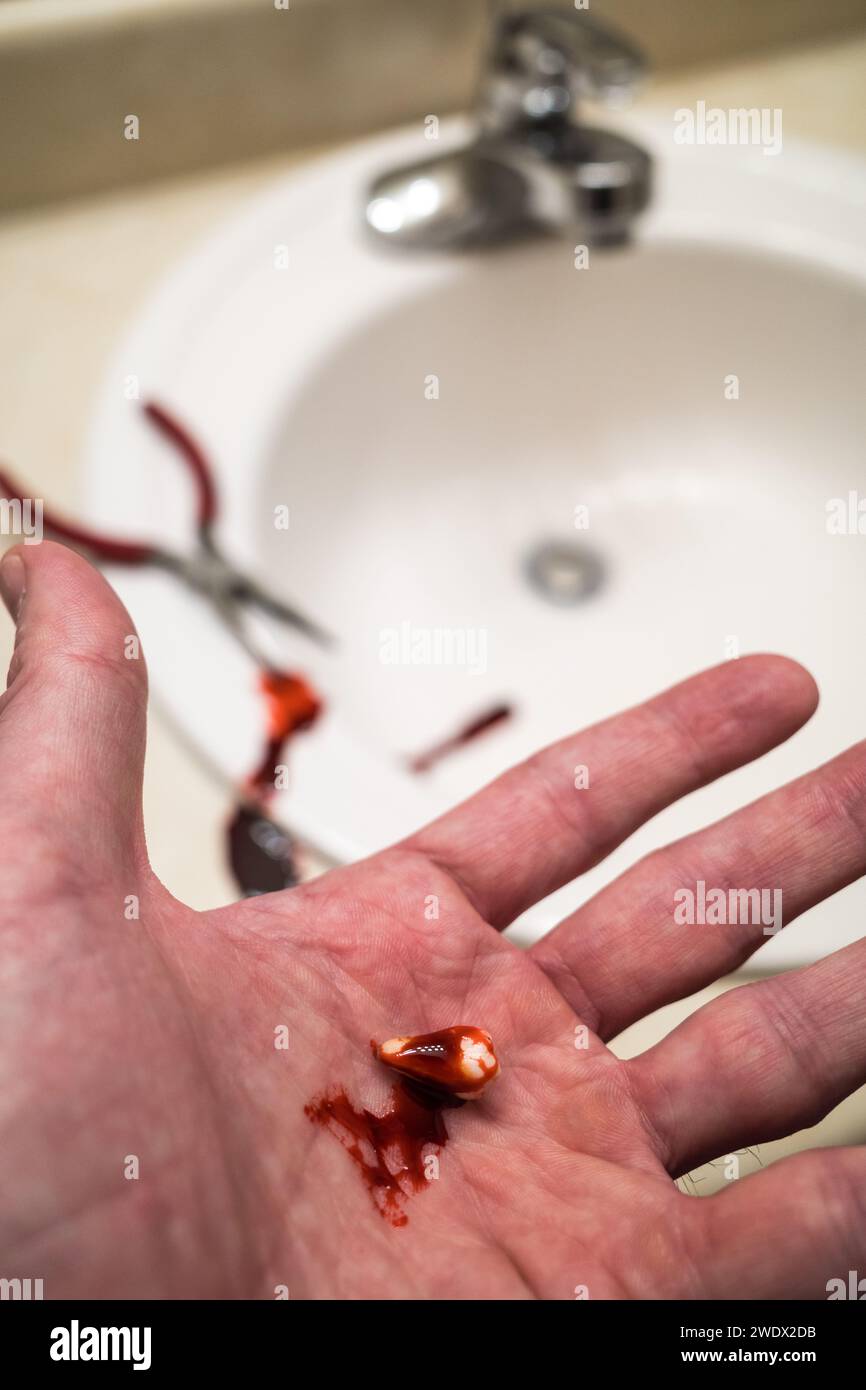 Seattle, USA. 22 Jan, 2024. Self tooth extraction concept Stock Photo ...