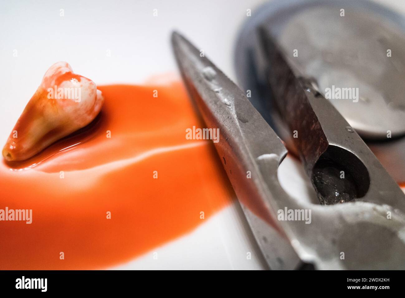 Seattle, USA. 22 Jan, 2024. Self tooth extraction concept Stock Photo ...